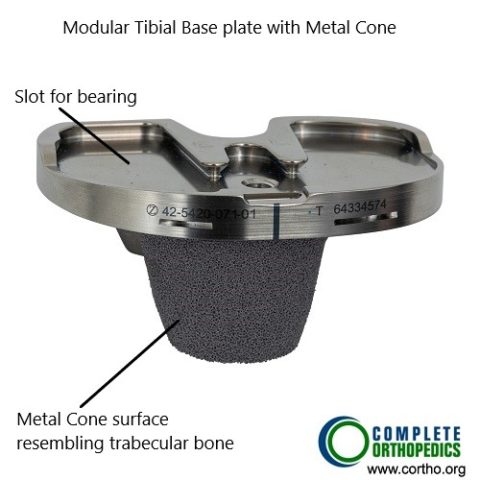 Knee Arthroplasty Implants - Complete Orthopedics & Podiatry
