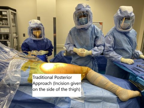 Anterior Hip Replacement, Hip Specialist in NY | Complete Orthopedics