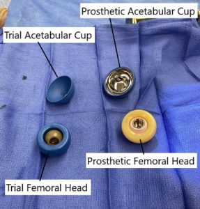 Total Hip Replacement Implants and Surgery | Complete Orthopedics