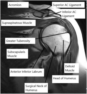 Rotator Cuff Tear New York | Shoulder Specialist