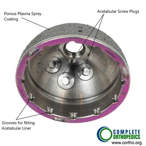 Anterior Hip Replacement, Hip Specialist in NY | Complete Orthopedics