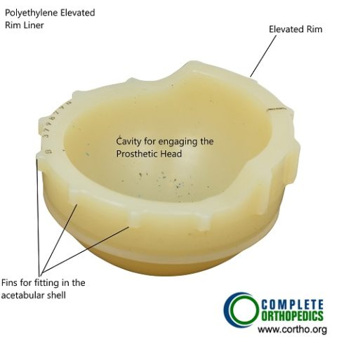Total Hip Joint Dislocation - Complete Orthopedics & Podiatry ...