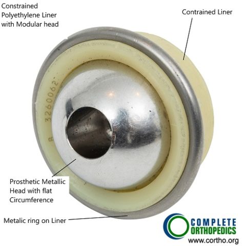 Total Hip Joint Dislocation - Complete Orthopedics & Podiatry ...