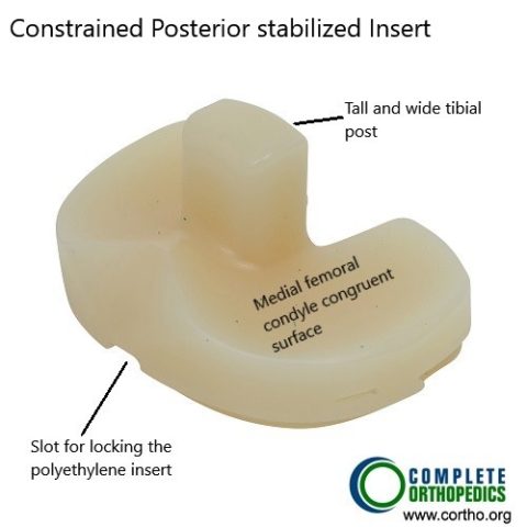 Complex Revision Hip & Knee Joint Replacement New York | Bayside NY