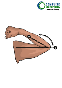 Scheduled Loss of Use for Elbow for Workers - Complete Orthopedics