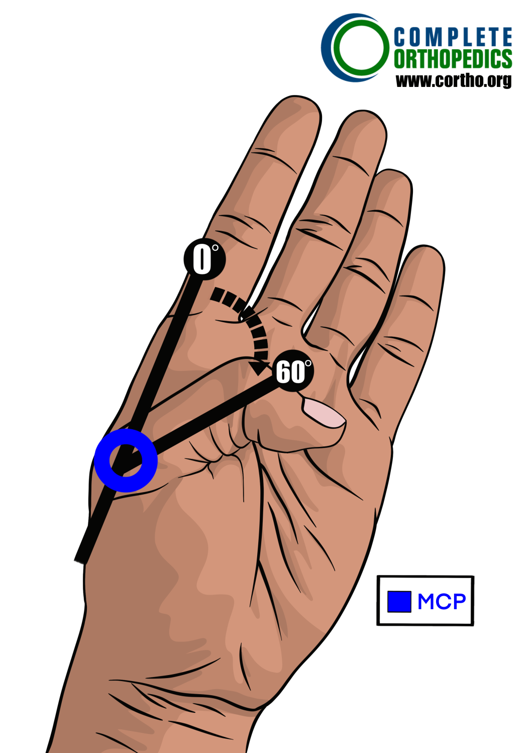 Scheduled Loss of Use for Upper Extremities - Complete Orthopedics Scheduled Loss of Use for Upper Extremities - Complete Orthopedics