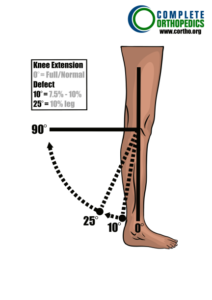 Scheduled Loss of Use for Knee and Tibia - Complete Orthopedics